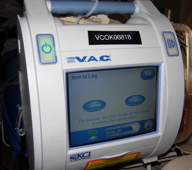 ENFERMAGEM: CURATIVOS E FERIDAS: Curativo a Vácuo