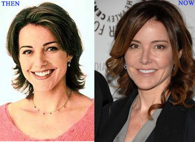 Christa Miller Plastic Surgery Before and After Nose Job, Breast ...