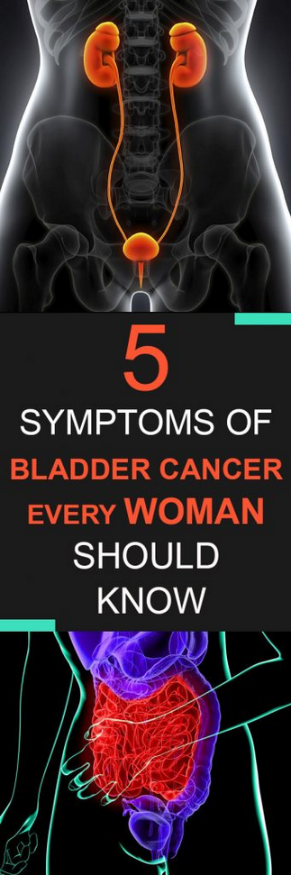 5 SYMPTOMS OF BLADDER CANCER EVERY WOMAN SHOULD KNOW - Health Hacks