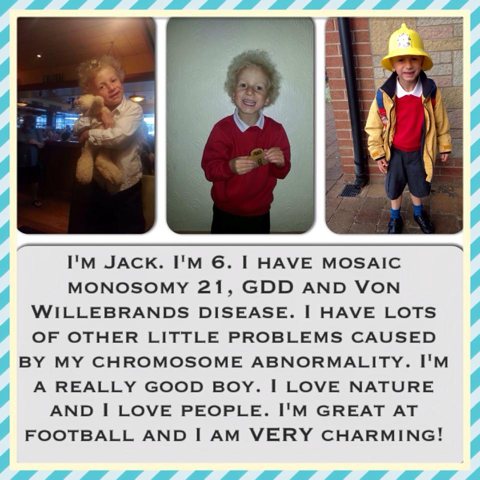 Raising a son with Mosaic Monosomy 21 + 6 girls: Rare chromosome ...