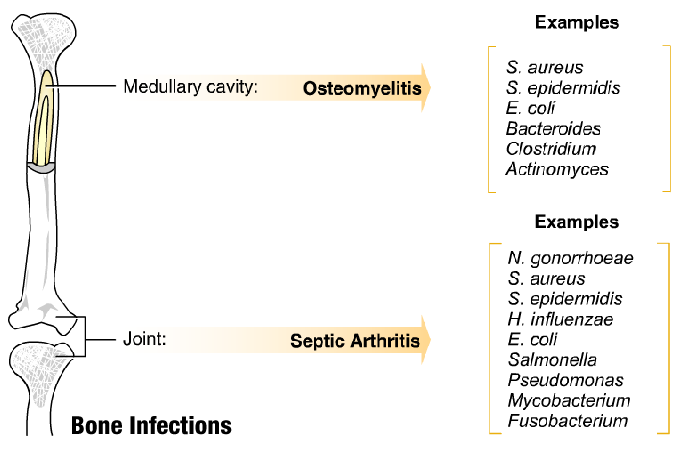 Basic Bacteriology: Categories of Infections