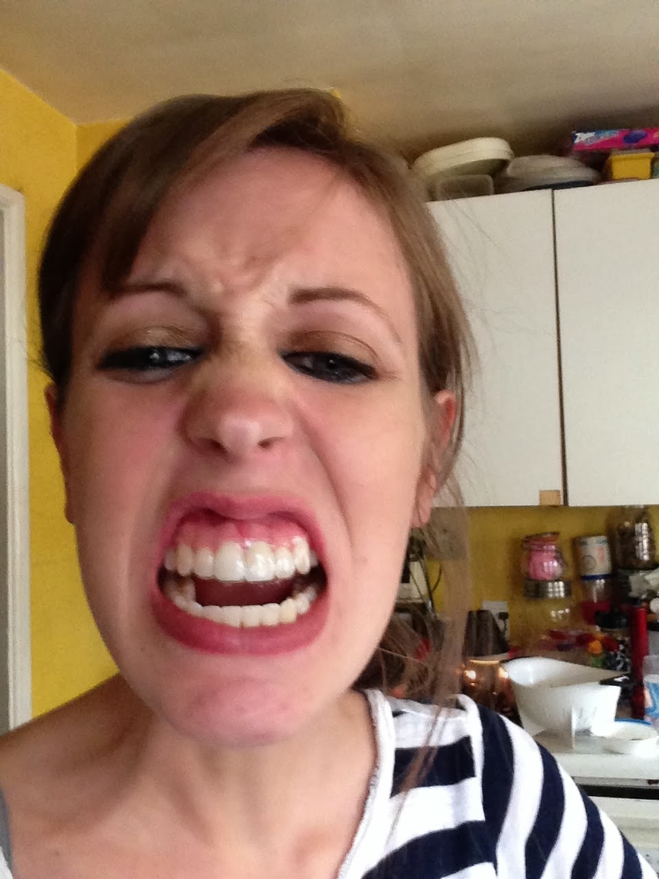 23 year old brace face...