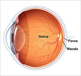 ABLASIO RETINA