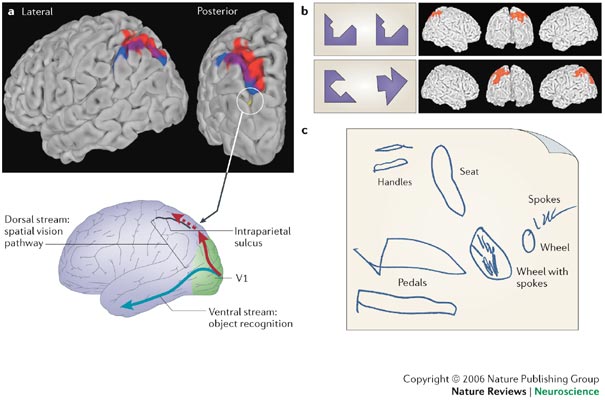 Understanding Williams Syndrome: Visuo-spatial difficulties and how ...