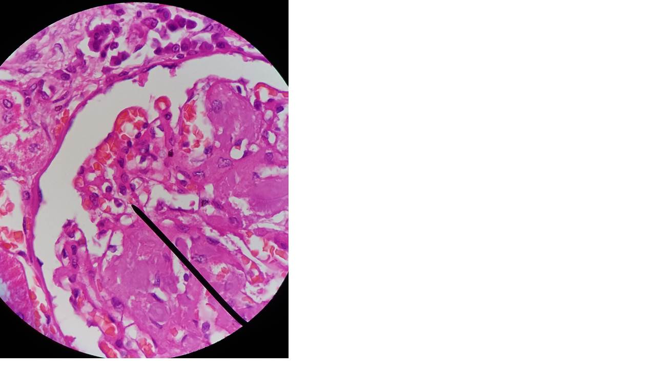 HISTOLOGIA90: RIM NORMAL E GLOMERULONEFRITES