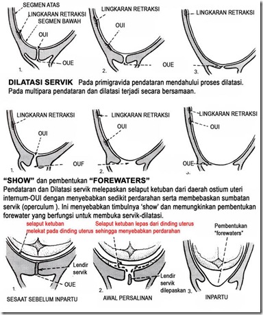 GAMBAR-GAMBAR | ASKEB 2 PERSALINAN DIAN HUSADA