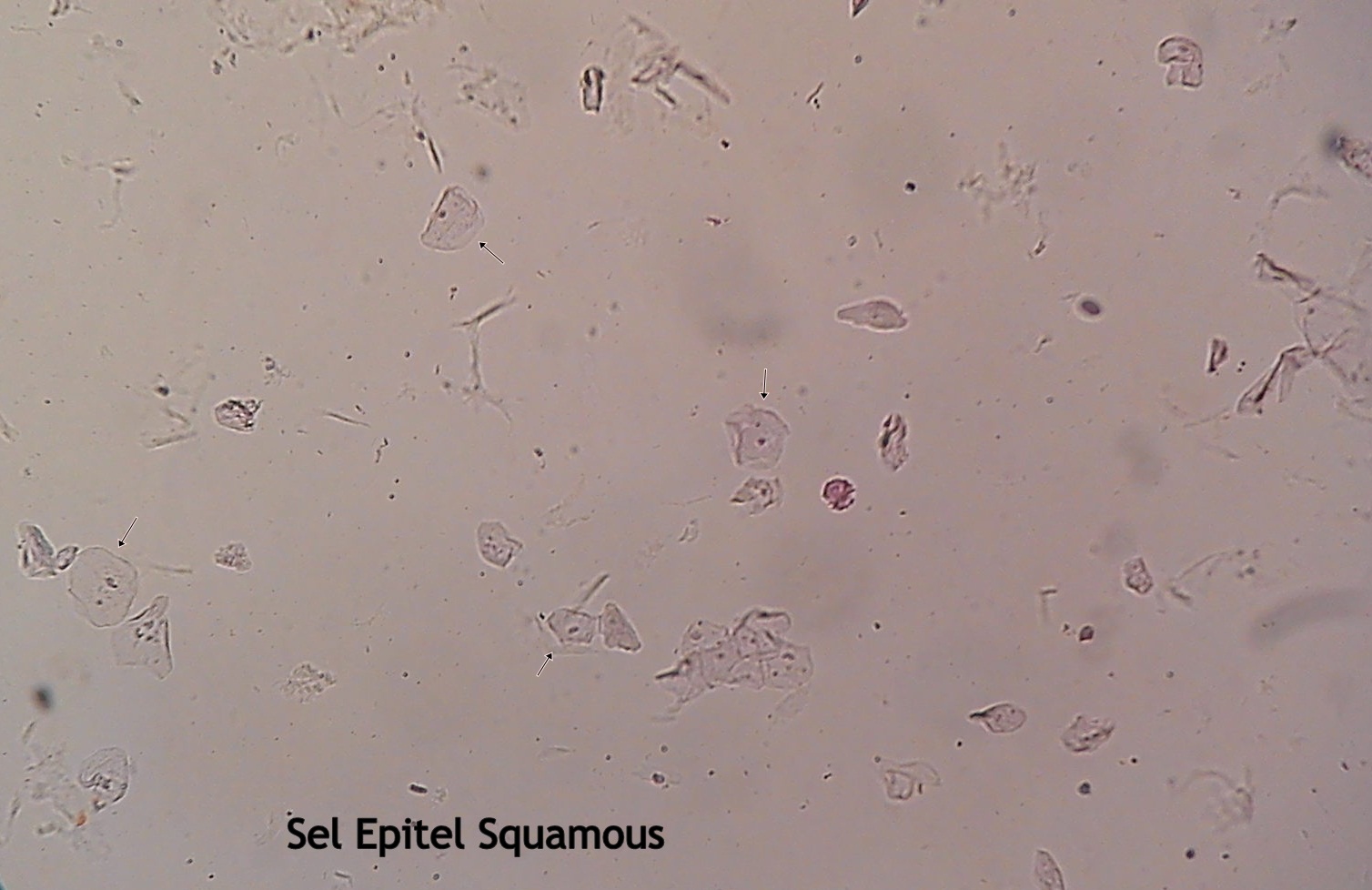 Sedimen Urine Metode Pewarnaan (Stainning) | Analis Kesehatan