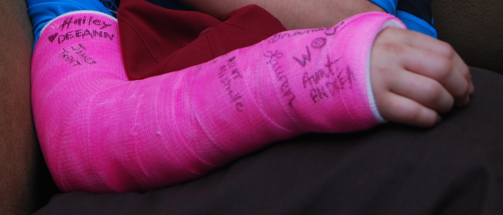Pink Arm Cast