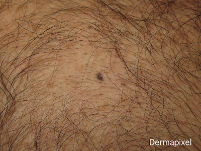 Dermapixel: mayo 2019