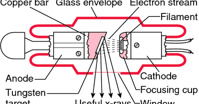 What is Anode? ~ Radiology Buzz