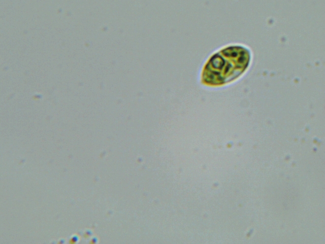 Amateur Algae culturing and cultivation : More Characium pringsheimii ...