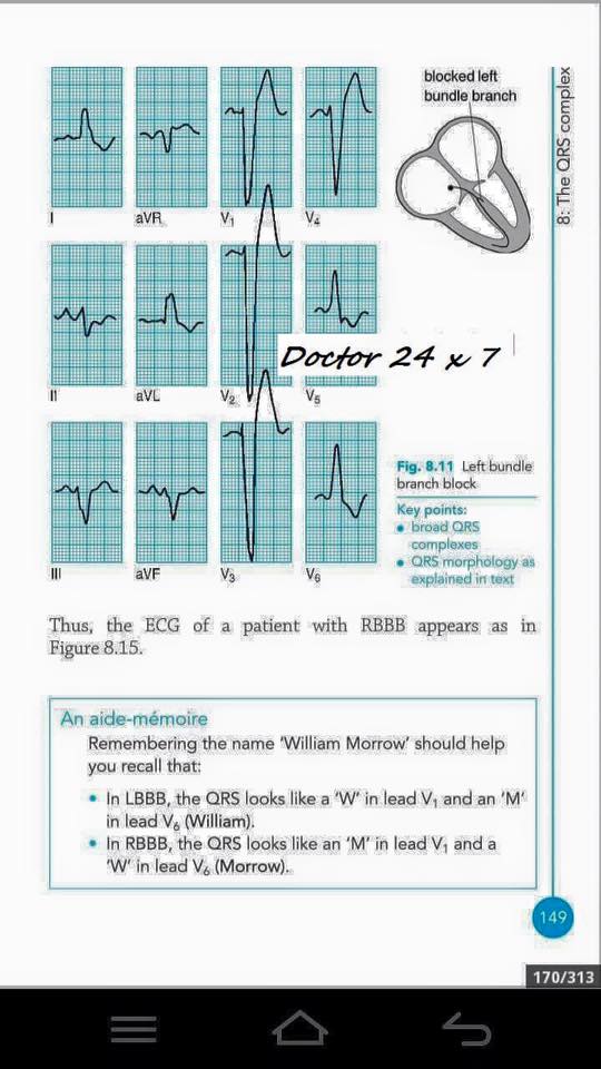amudu: Easy way to learn ECG. Step by Step in a very easy way
