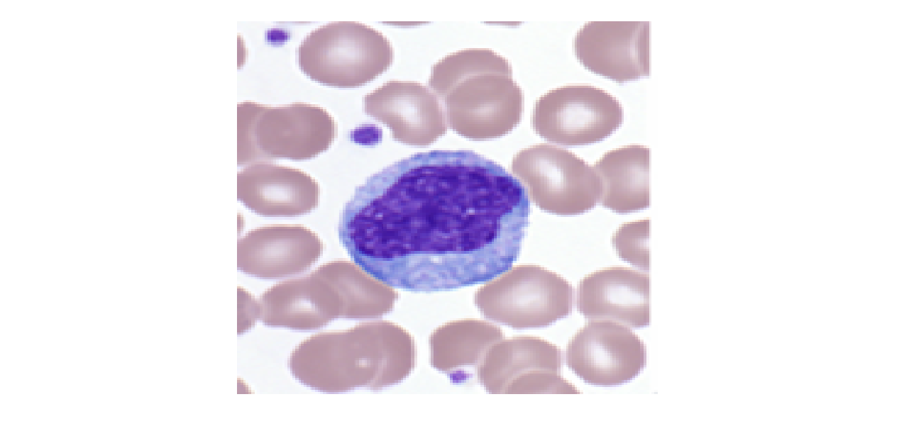 BERBAGI INFO TEKNOLOGI ALAT KESEHATAN: HEMATOLOGI ANALYZER