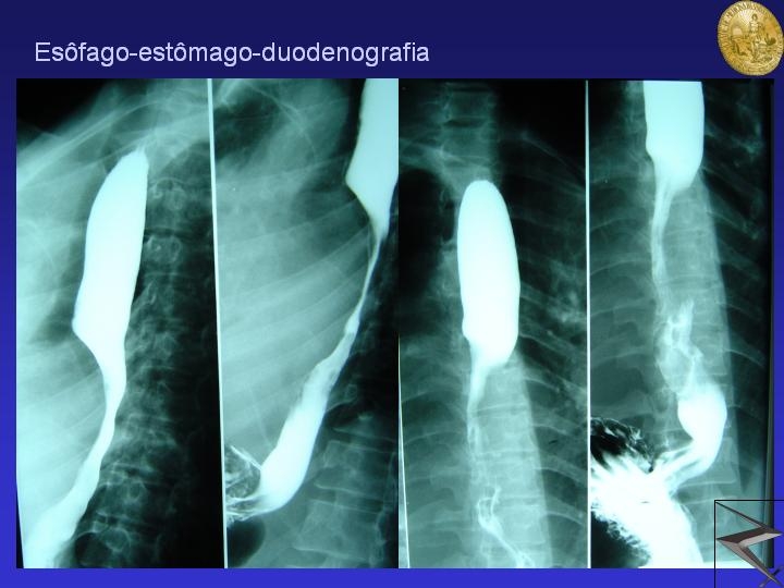 Jornal Eletrônico da Radiologia: Abril 2011