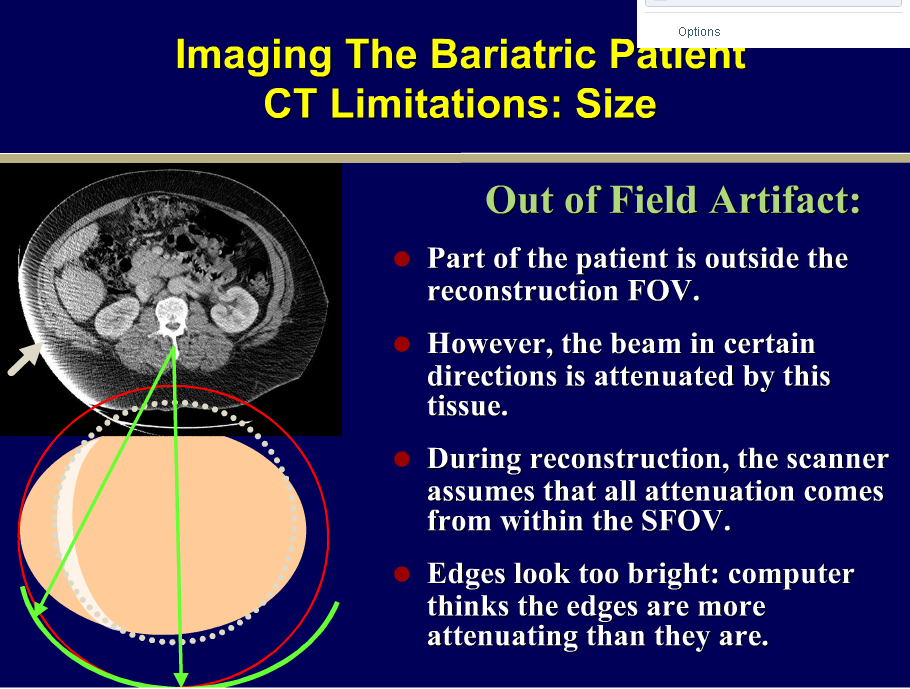 rsna: obesity CT