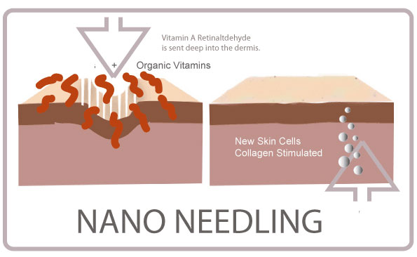 Gut Health, Skin Needling, Microdermabrasion, Food Intolerance Test ...