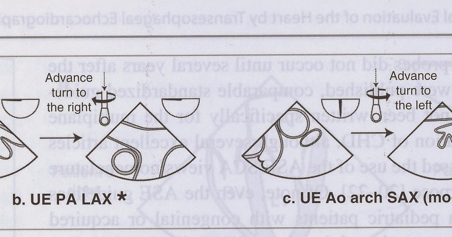 Pedi cardiology: TEE - Basic Views & terminology