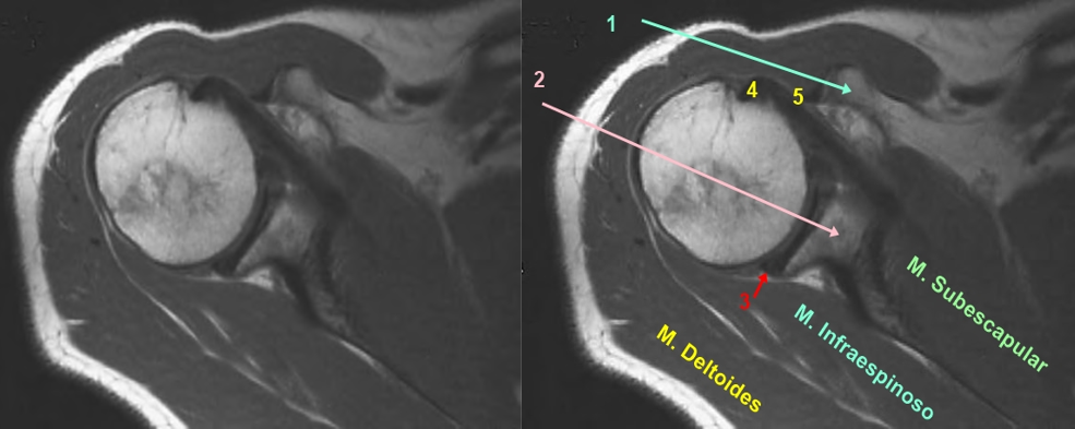 ANATOMÍA DEL HOMBRO Y CINTURA ESCAPULAR.