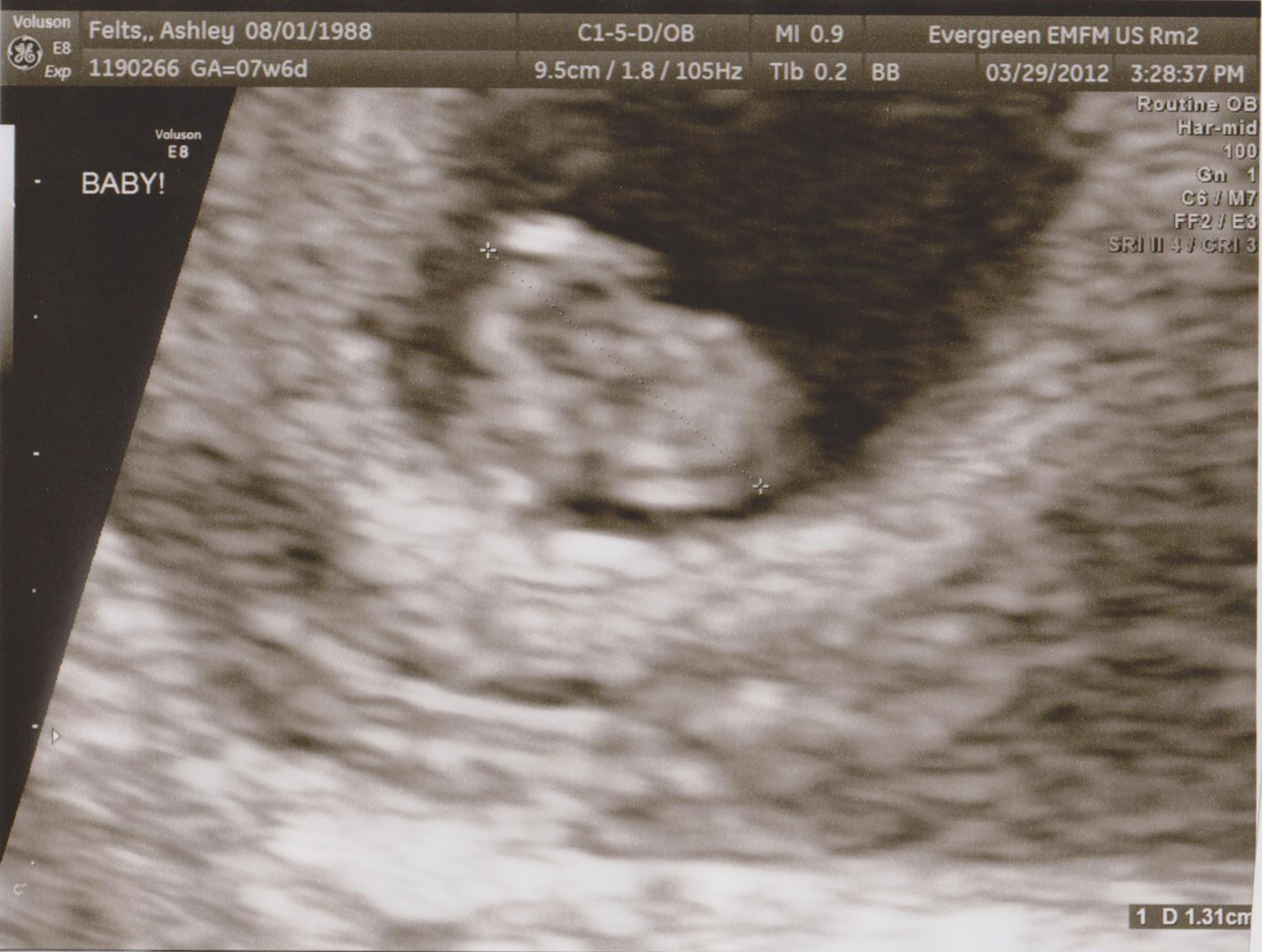 Baby Felts: March 2012