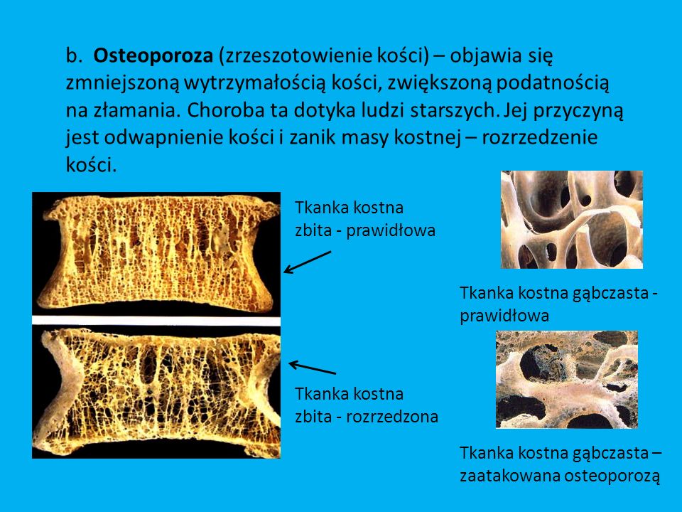 Biologia - nauka o życiu: Tkanki zwierzęce, cz. 1 - Tkanka nabłonkowa i ...