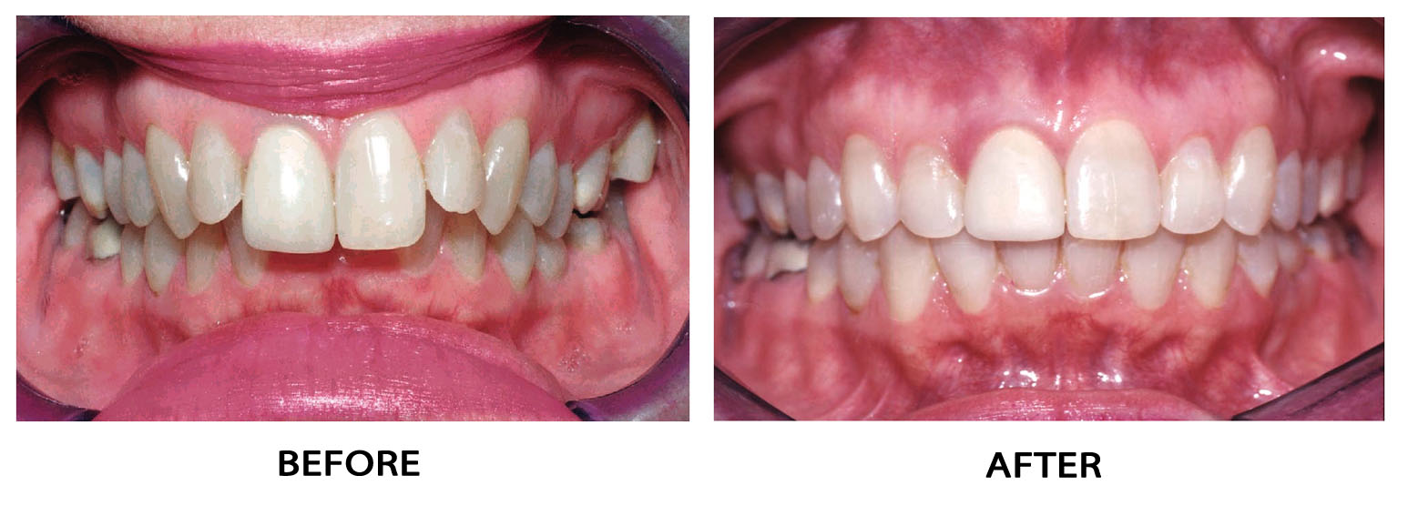 Al Fardan Orthodontics: COMMON PROBLEMS