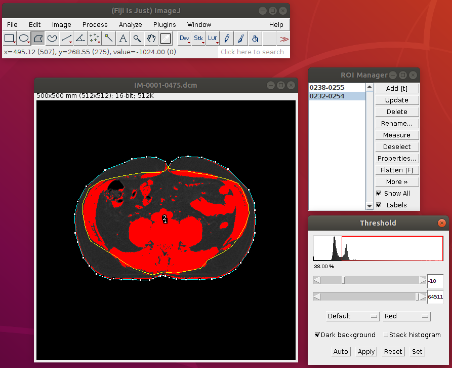 次に、Threshold機能を使って、脂肪とそれ以外の画素値を2値化します。