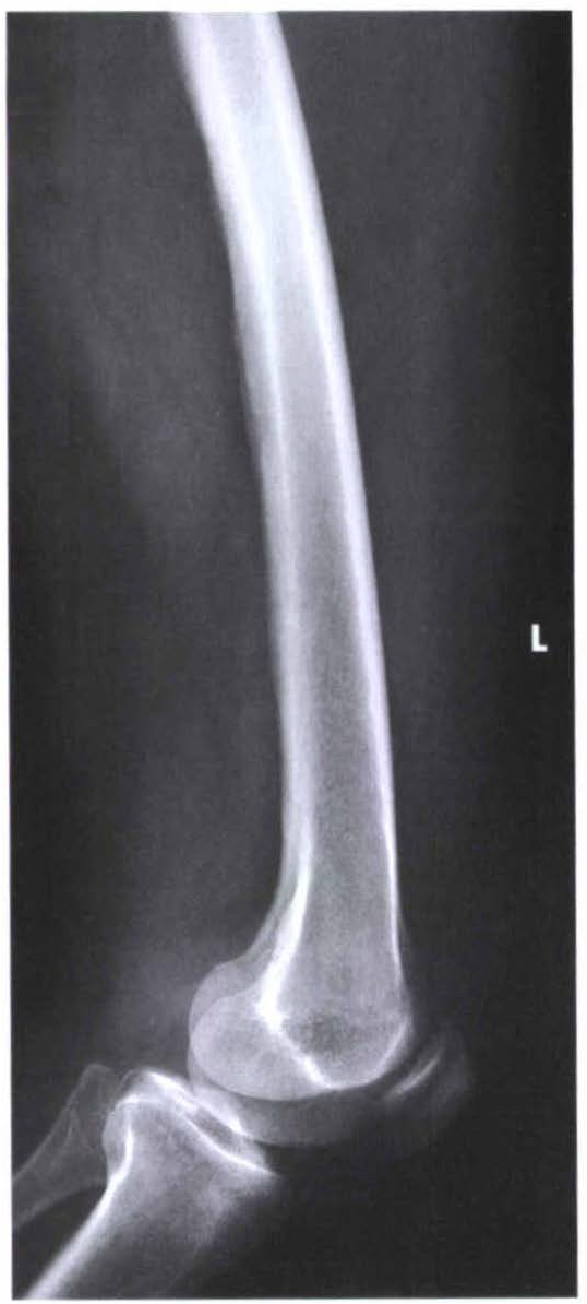 Gudang Medis: teknik radiografi femur