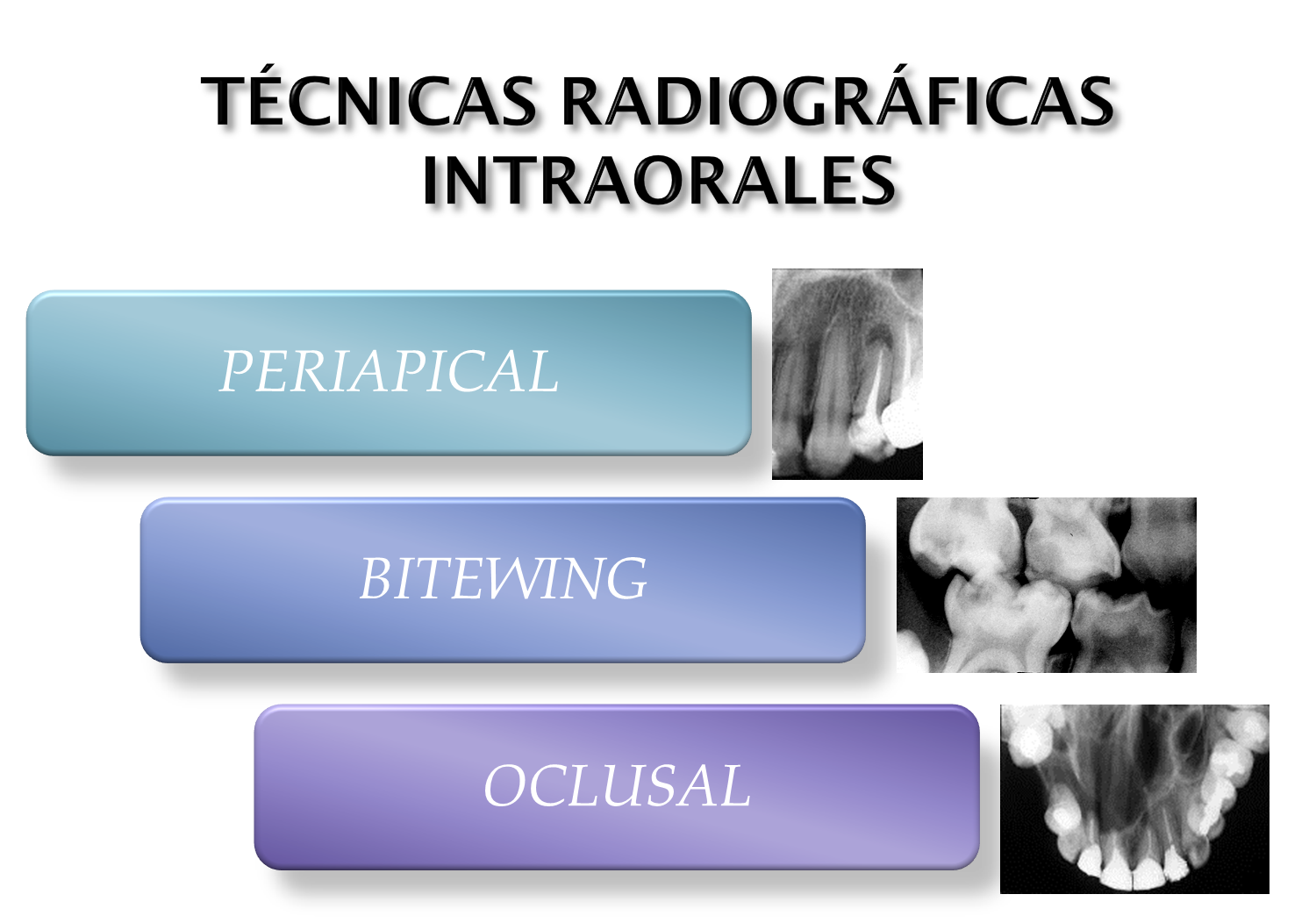 Radiología oral y maxilofacial: Técnicas radiográfiacas intraorales