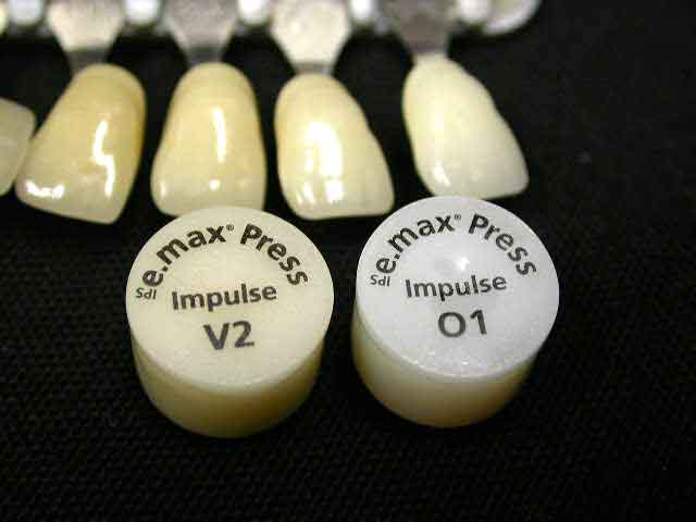 SAYAKA(サヤカ)徒然: e.max Impulse インパルス