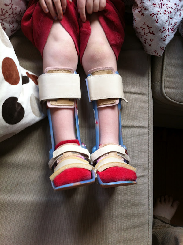 The Hazel Blog: Molly's braces