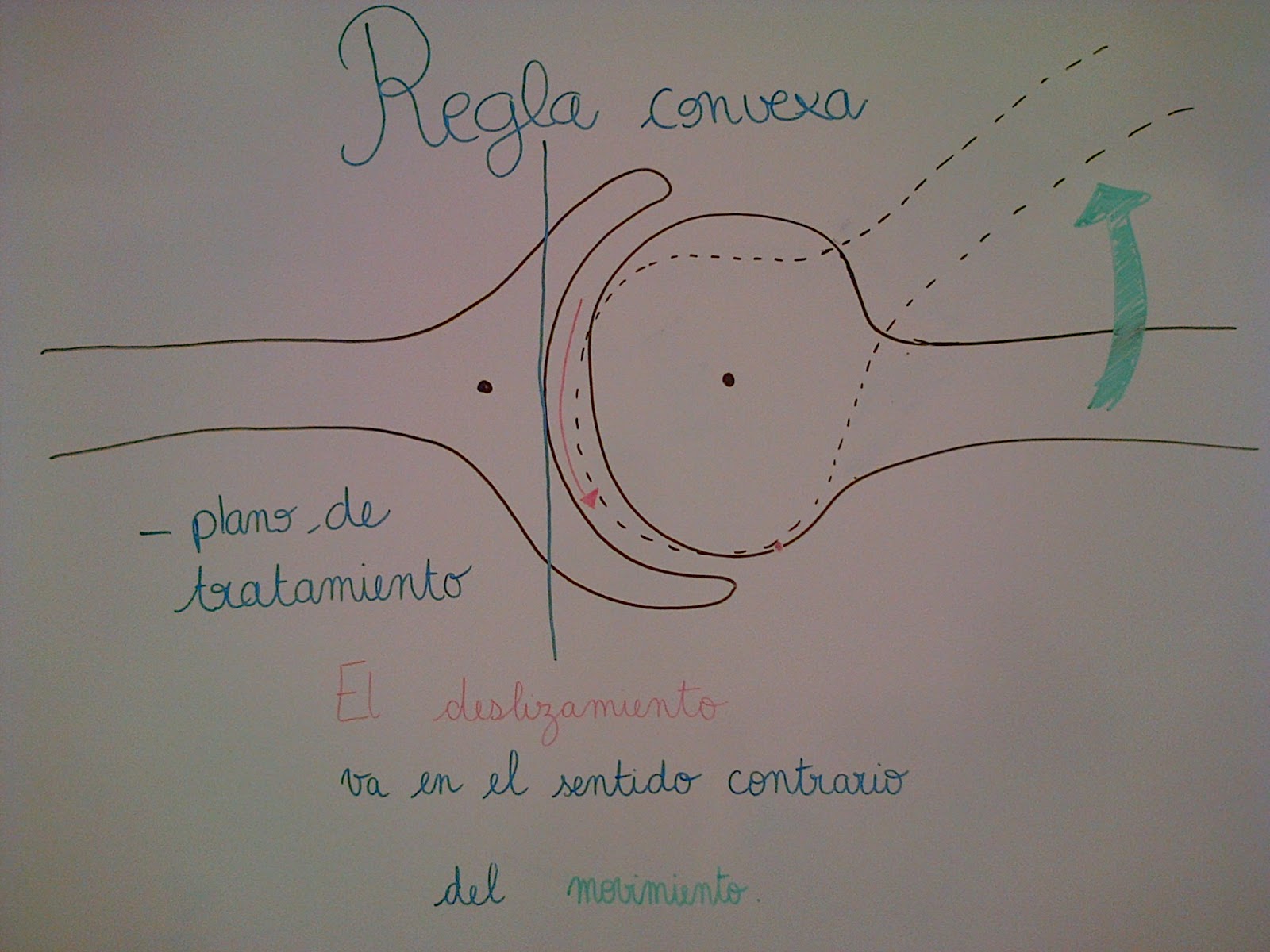 Concave Vs Convex Spine