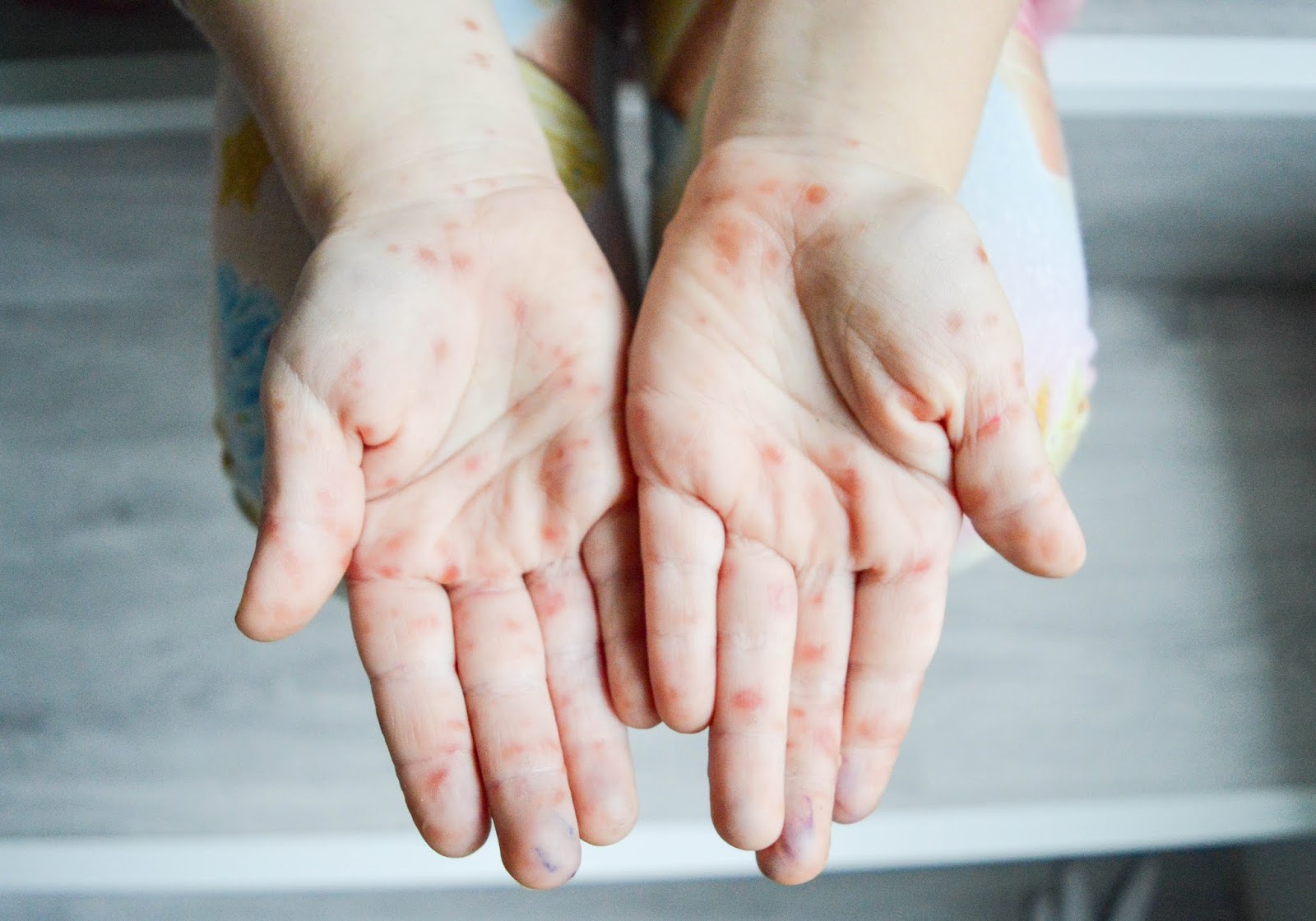 Kädenjälkiä sydämessä: PASKAMAINEN ENTEROROKKO