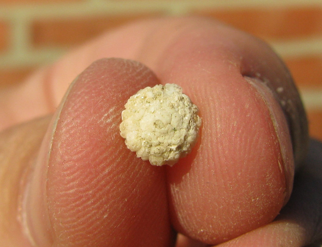 Views of the Mahantango: Salenia and Echinogalerus echinoids from Sweden