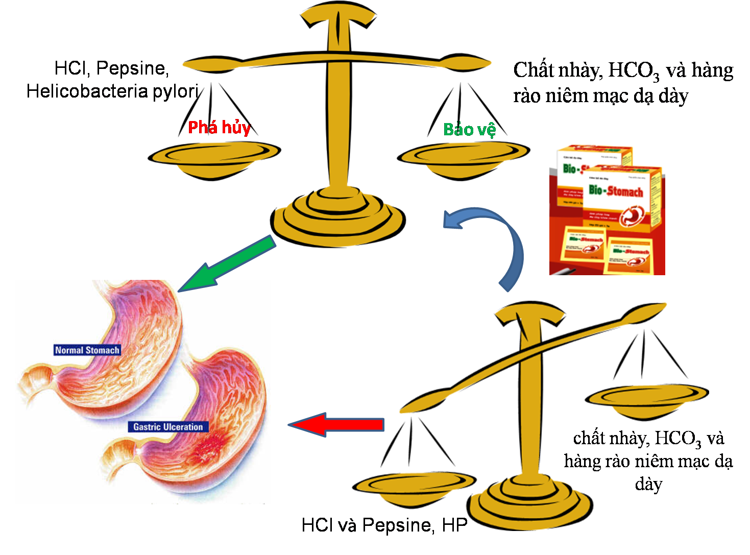 Bio-stomach: VIÊM LOÉT DẠ DÀY TÁ TRÀNG