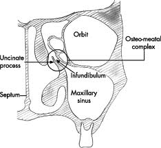 Sinusitis Understood: Anatomy of Sinusitis