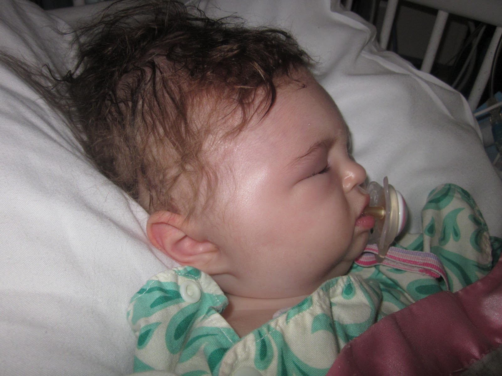 Meagan: Cranial Vault Reconstruction - Recovery Day 2