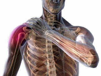 Rolul kinetoterapiei in tratarea periartritei scapulo-humerale