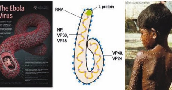 EBOLA VIRUS DISEASE PICTURES ~ Mzizi Mkavu