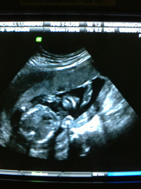 Our Journey Towards Parenthood: Congenital Anomaly Scan | My Little ...