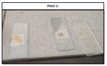 BIOLOGÍA HUMANA: HONGOS EN EL PAN