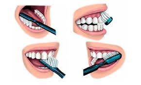Control de Placa Supragingival: INDICE DE Ö LEARY