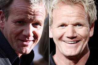 Gordon Ramsay Plastic Surgery Before and After Botox and Facelift ...