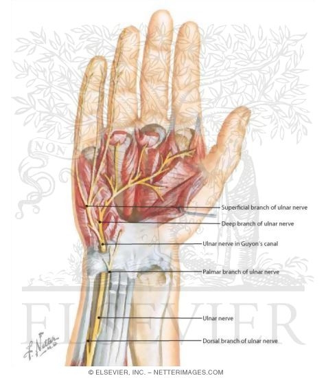 Ulnar Neuropathy - Trimazing