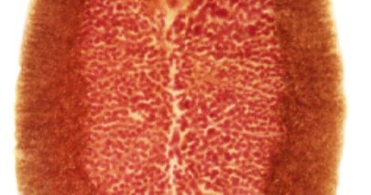 Lecture Notes in Medical Technology: Lecture #8: THE LIVER FLUKES