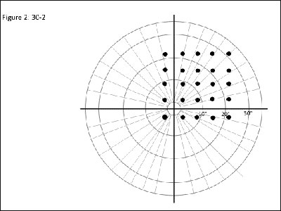 GLAUCOMA SPECIALIST BLOG: "THE GLOG"