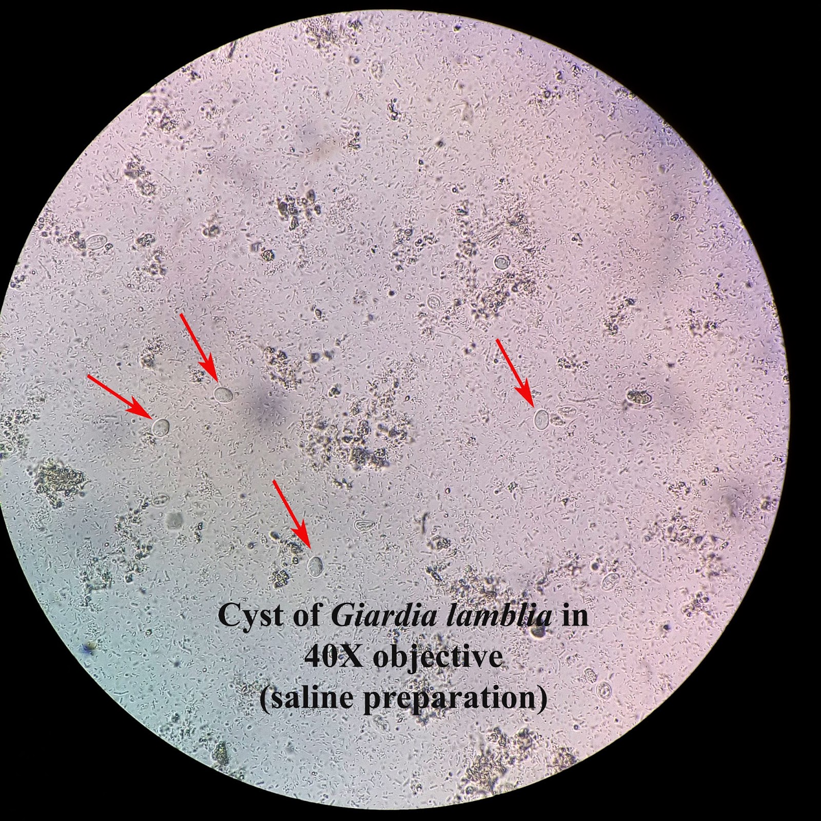 MICROBIOLOGY BLOG FOR STUDENTS (MBLOGSTU): Stages of Giardia lamblia ...