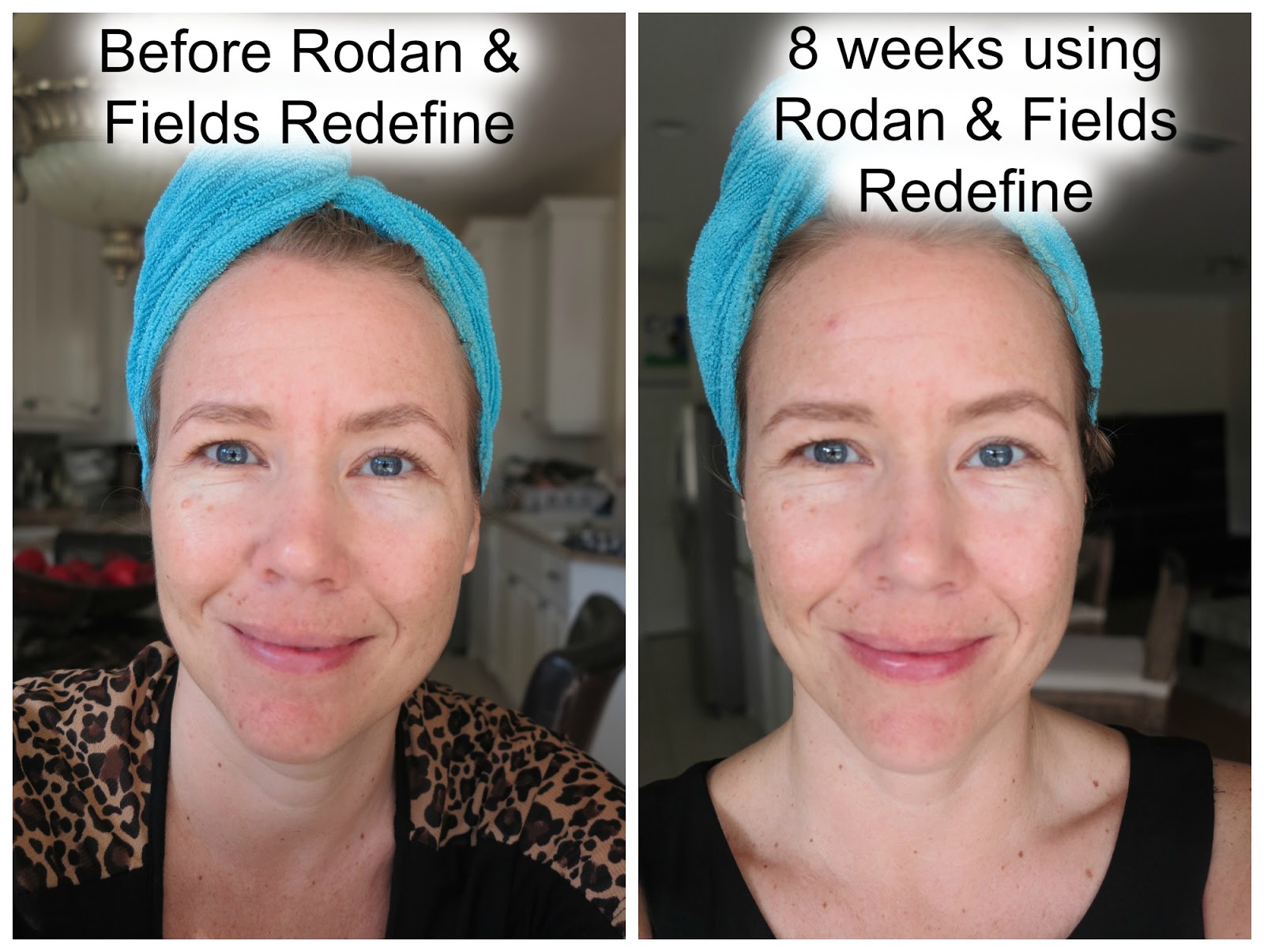 RODAN + FIELDS REDEFINE REGIMEN REVIEW | FOR THE APPEARANCE OF LINES ...