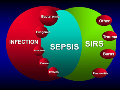 Σήψη: κίνδυνοι, πρόληψη - Η ΔΙΑΔΡΟΜΗ