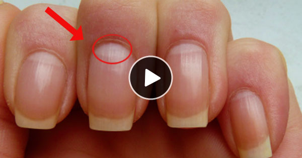 The Half Moon Shape on Your Nails Reveals Your Health Conditions
