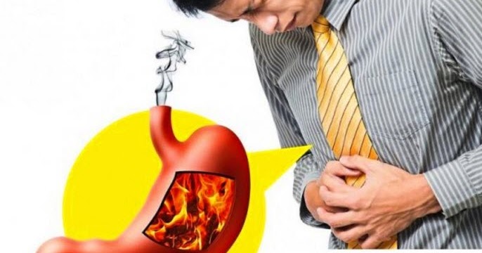 Apakah Benar GERD Disebabkan Justru Jumlah Asam Lambung Yang Kurang ...